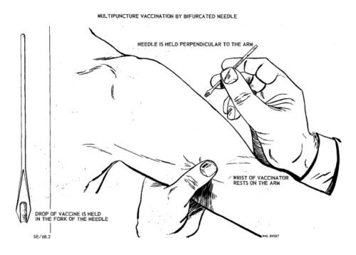 Why We Still Talk About Smallpox, Years After Eradicating the Virus ...